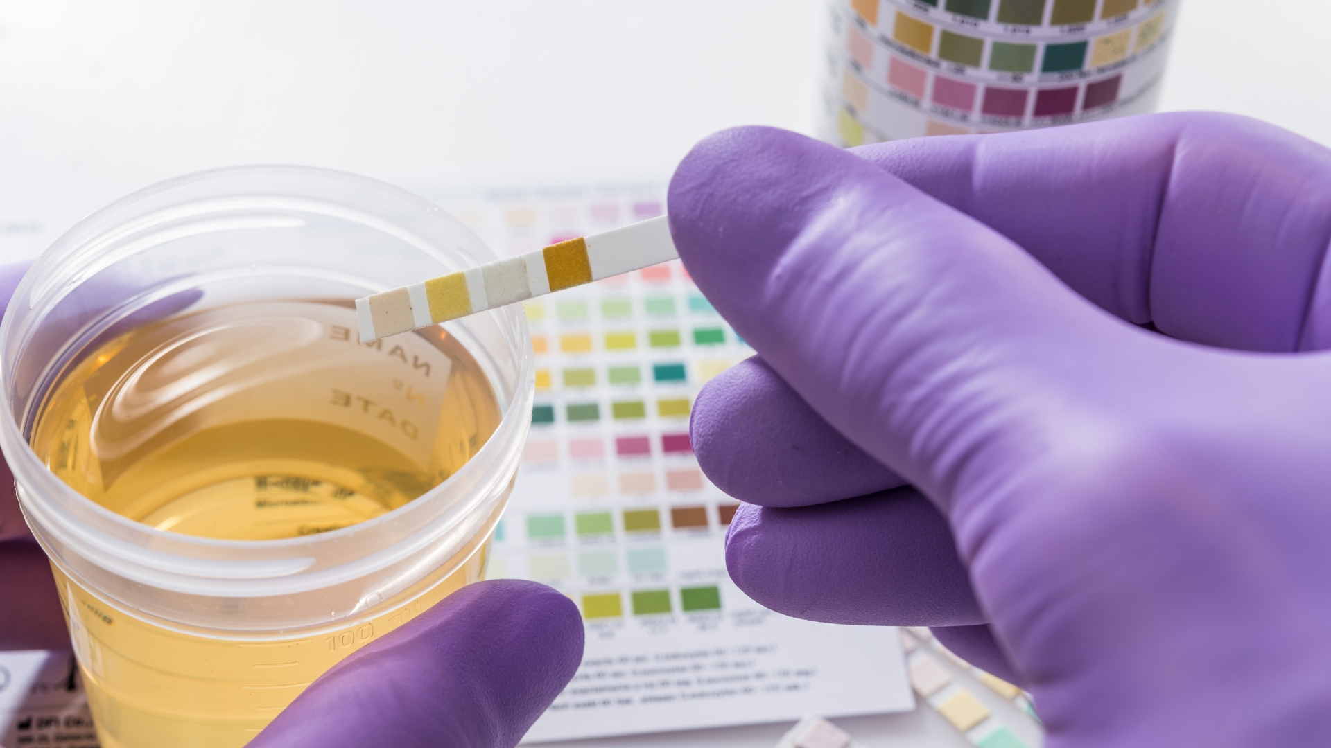 Urinometer: Alat untuk Analisis Kesehatan Urin dan Fungsi Ginjal – GRIN ...