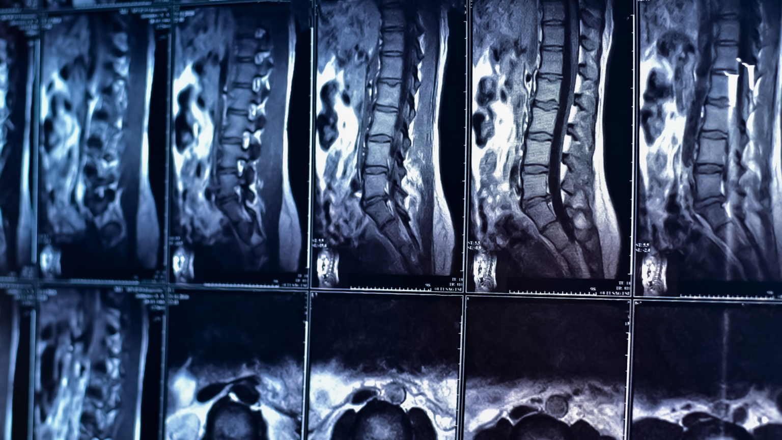 Jenis Pemeriksaan Radiologi Muskuloskeletal: MRI, CT Scan, hingga USG ...
