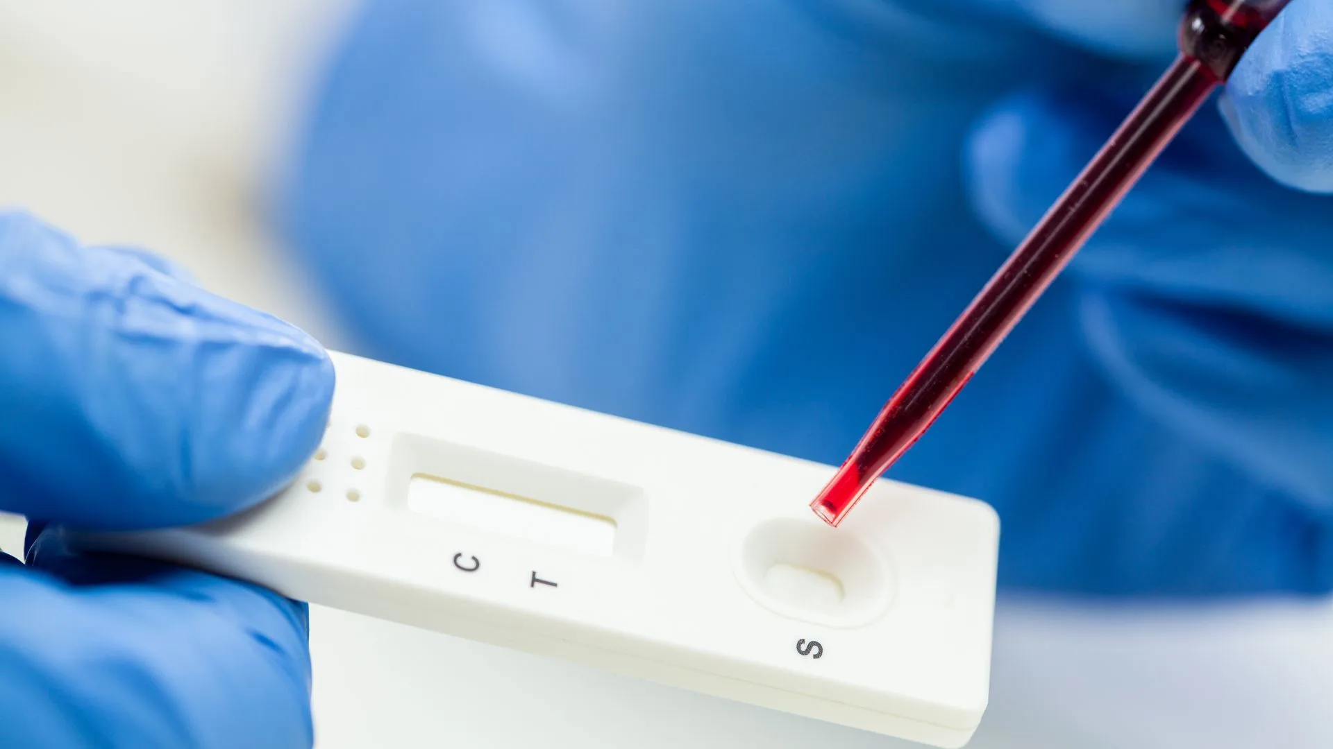 Keunggulan G6PD Test Kit Point-of-Care: Cepat, Praktis, dan Akurat ...