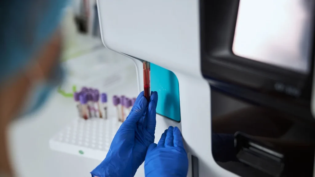 Tips Penyimpanan dan Penanganan Hematology Reagent agar Tetap Stabil ...