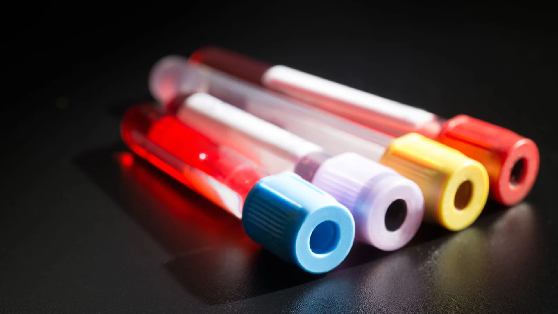 Mengenal Plasma Separator Tube: Tabung Khusus untuk Uji Plasma Darah ...