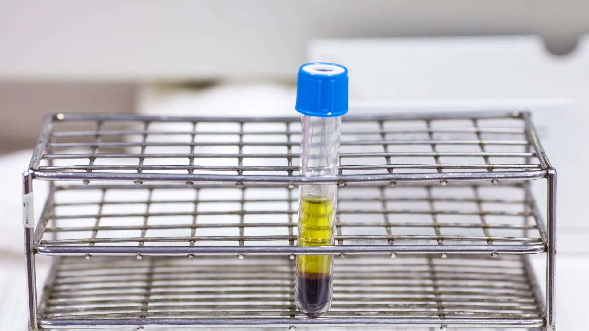 Keunggulan Plasma Separator Tube Dibandingkan Tabung Lain - GRIN Astra ...