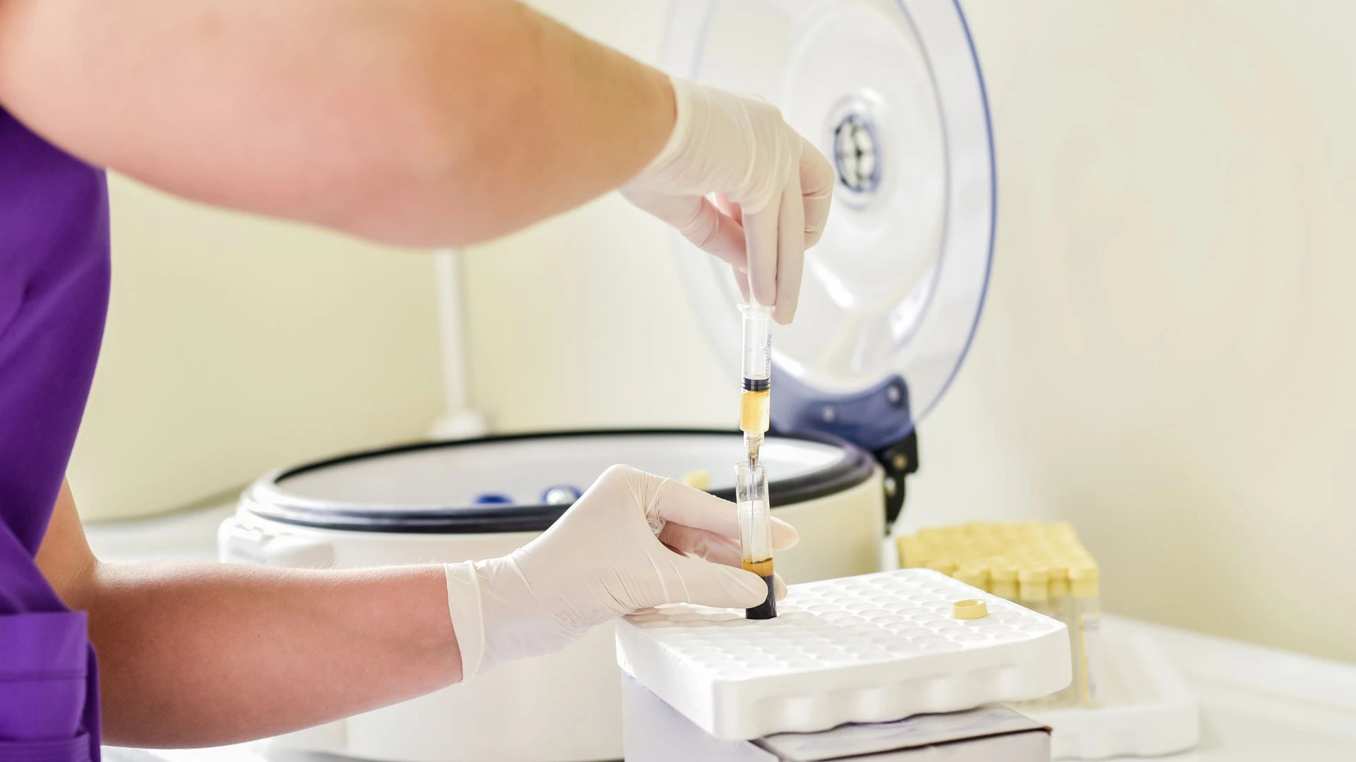 Teknologi Terkini dalam Platelet Aggregometer: Lebih Cepat dan Presisi ...