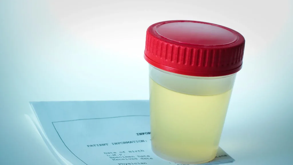 Fungsi Urine Culture Bottle dalam Diagnosis Bakteri Penyebab ISK - GRIN ...