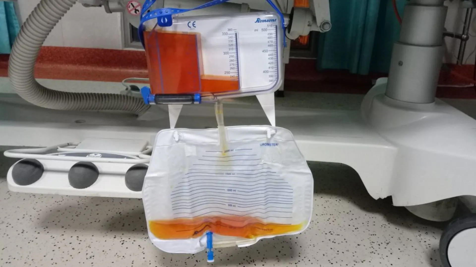 Cara Kerja Urine Output Monitor dan Interpretasi Hasilnya - GRIN Astra ...