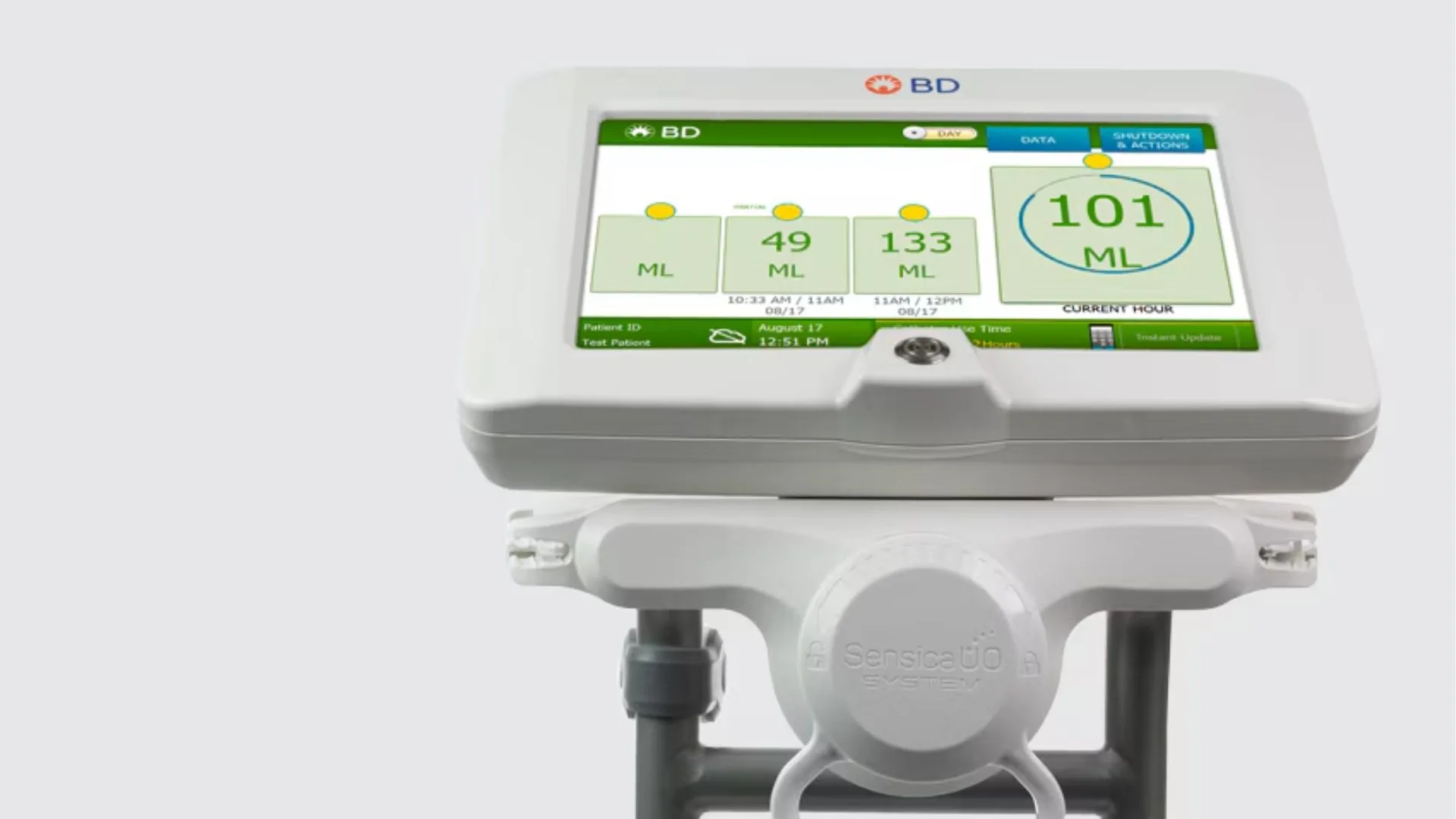 Keakuratan dan Keunggulan Digital Urine Output Monitor Dibandingkan ...