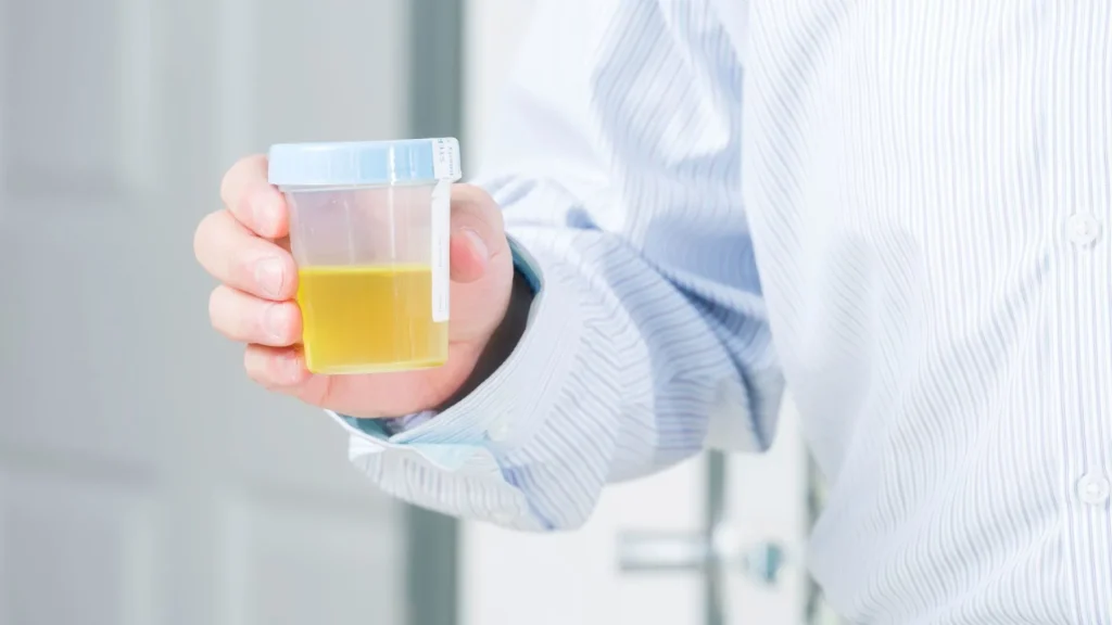 Urinometer: Alat Klasik yang Masih Relevan di Era Modern - GRIN Astra ...