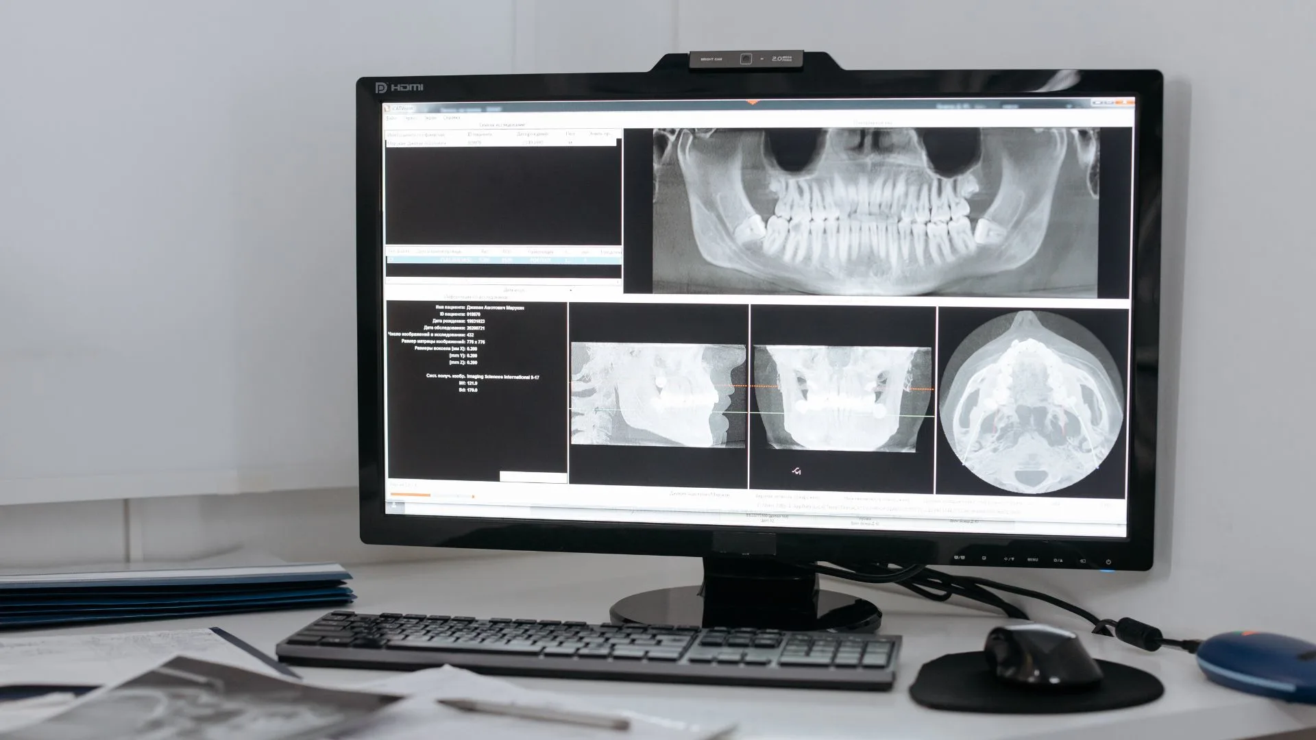 Bagaimana Distribusi Hasil X-Ray Digital Mempermudah Dokter? - GRIN ...